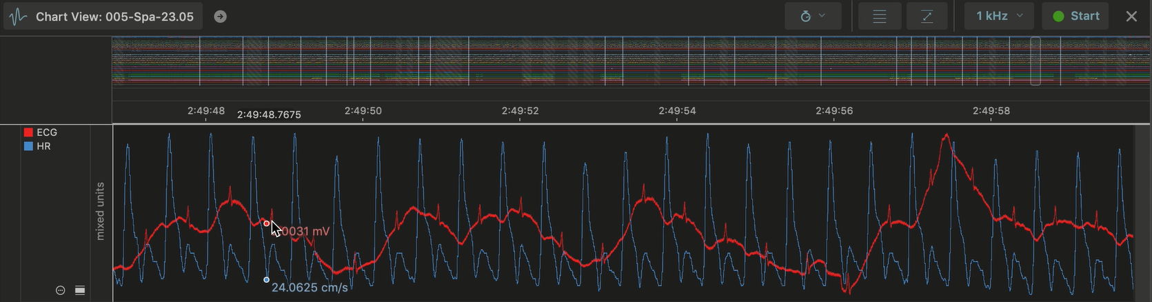 为什么选择LabChart Lightning？生理学家Keith Siew分享了Lightning如何为他节省时间并简化他的分析... | ADInstruments